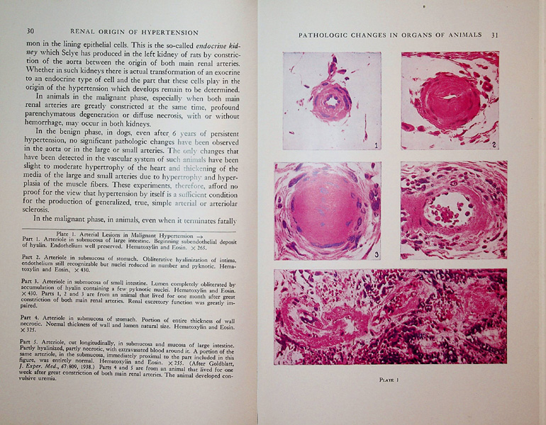 The Renal Origin of Hypertension